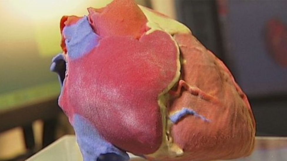 Lifelike 3D-printed heart to help train surgeons - BBC News