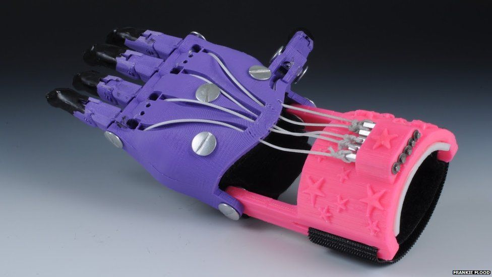 Handy work: The making of Hayley Fraser's new hand - BBC News