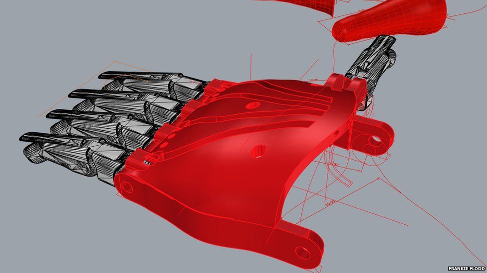 Handy work: The making of Hayley Fraser's new hand - BBC News