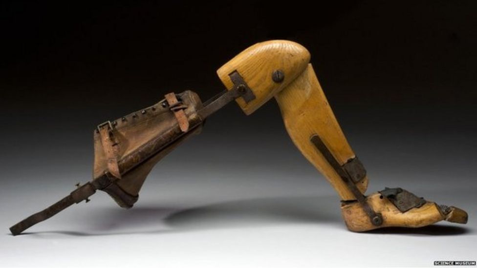 Amputation pain 'still a challenge' for medics - BBC News