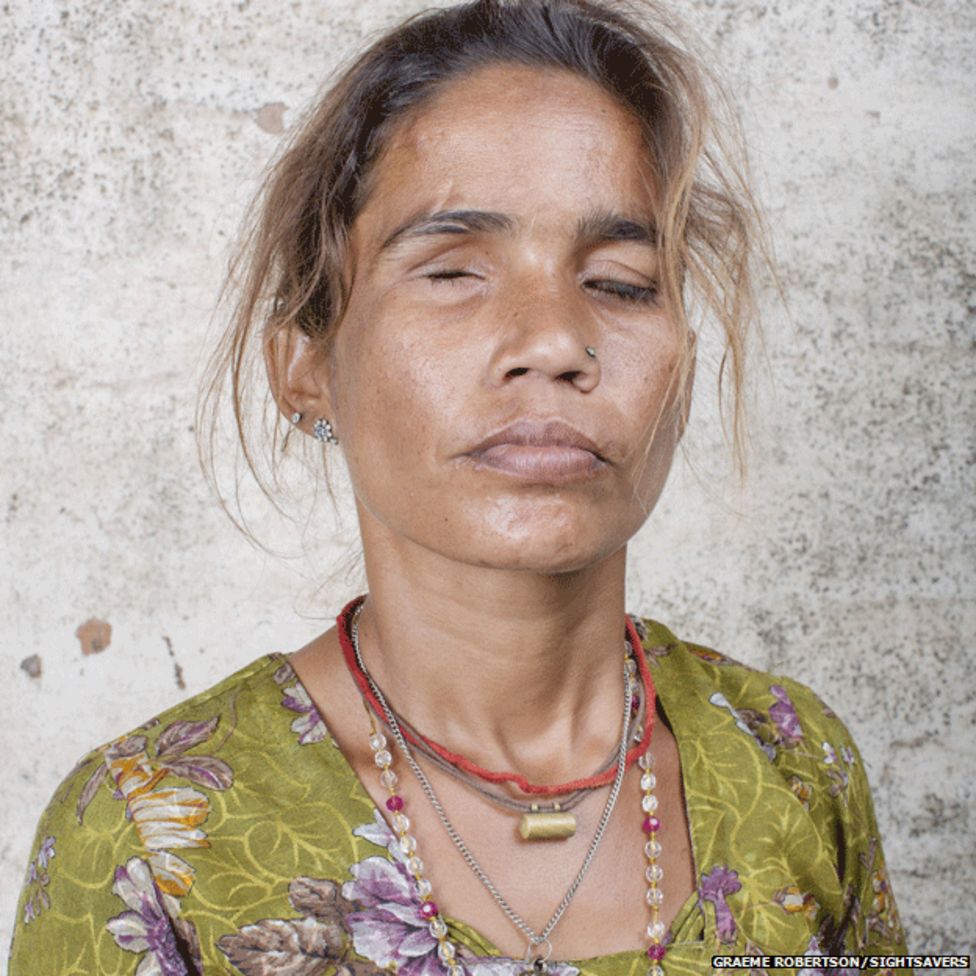 In pictures: Stories of disabled life in India - BBC News