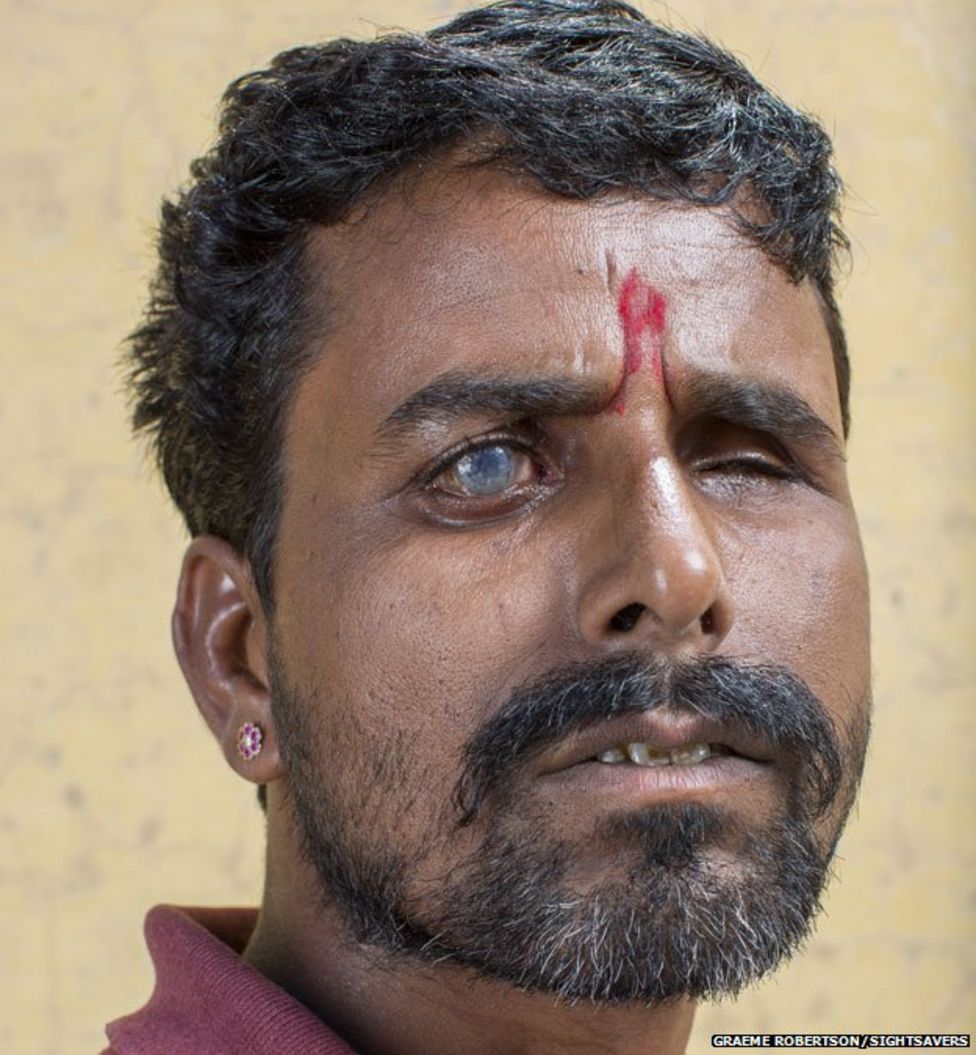 In pictures: Stories of disabled life in India - BBC News