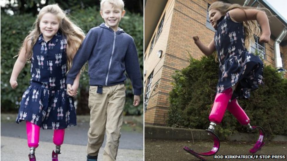 Grace Matthews, 7, gets life-changing blade legs - BBC News