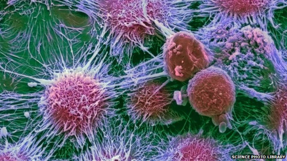 Cuts to cancer treatments announced - BBC News