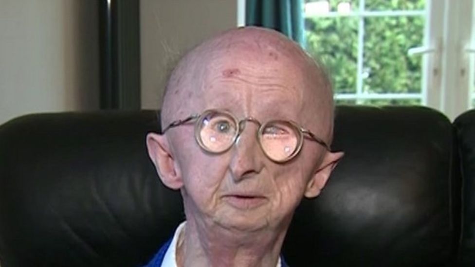Alan Barnes: Fundraiser Katie Cutler meets mugging victim - BBC News