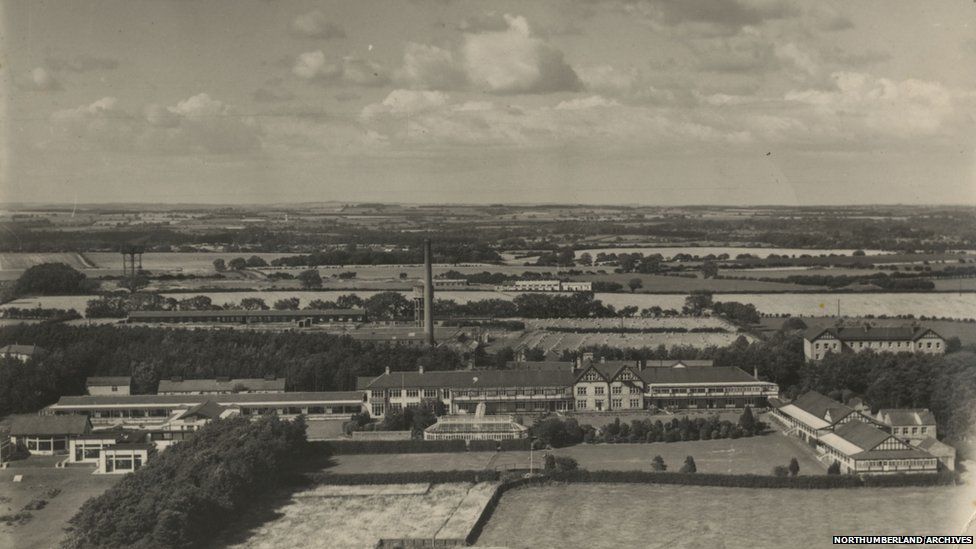 Stannington Sanatorium photos shine light on TB before antibiotics ...