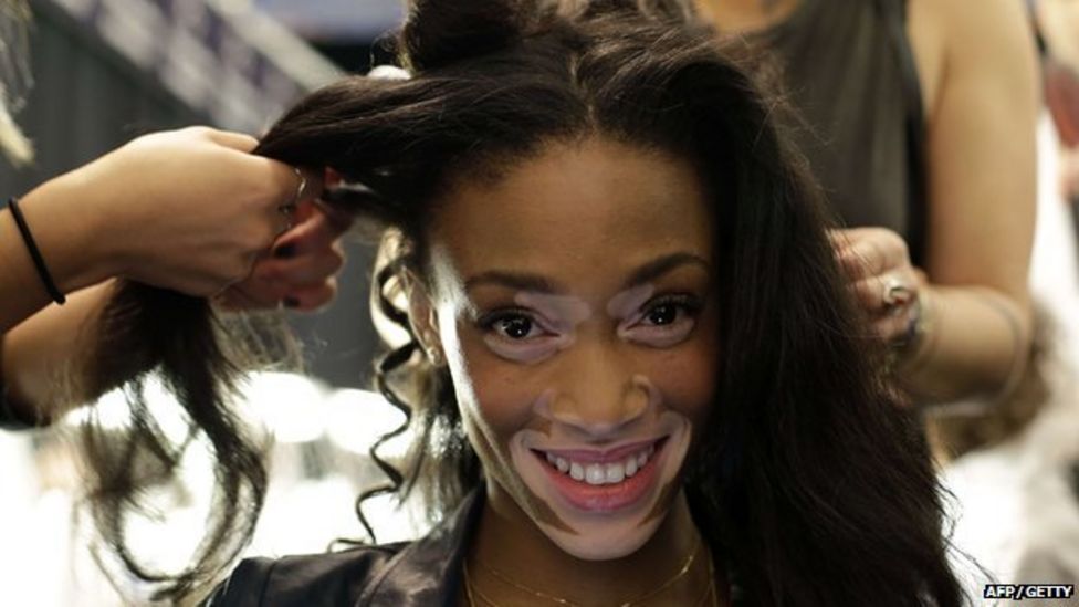 Vitiligo model, Winnie Harlow, becomes New York catwalk star - BBC News