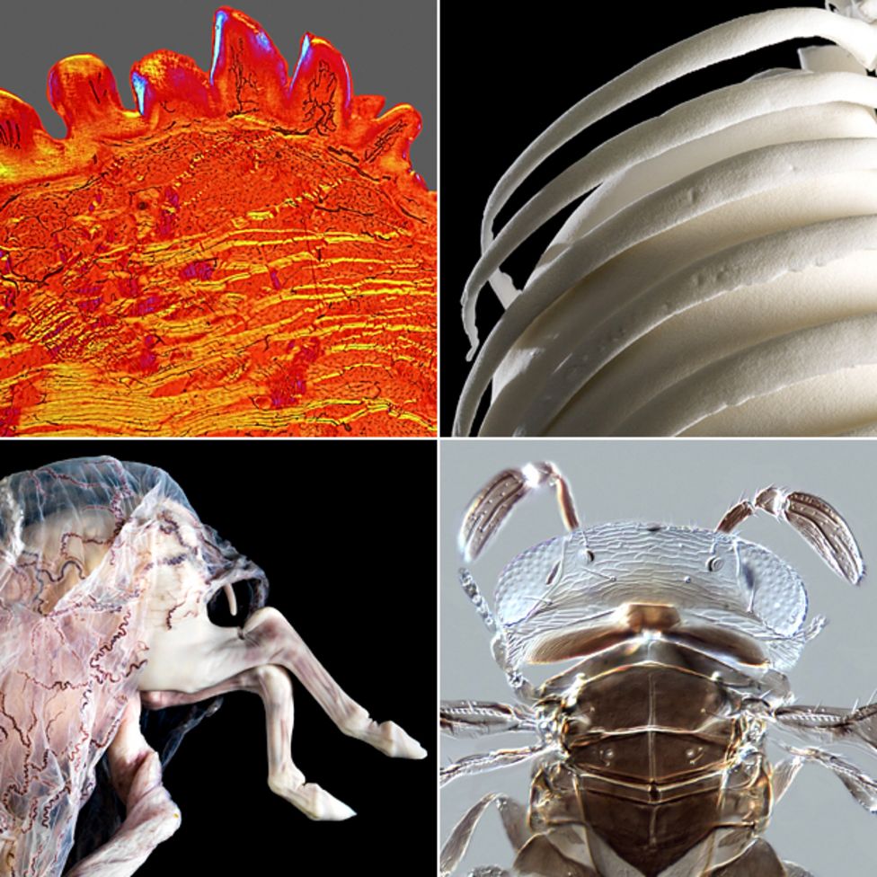 The art of science - Wellcome Images 2015 - BBC News