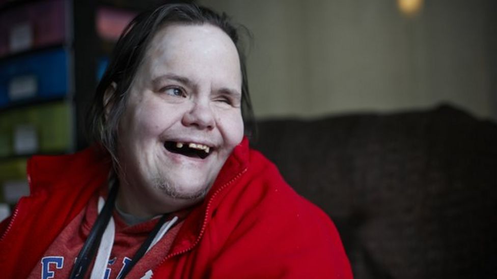 Why are a quarter of disabled people lonely? - BBC News