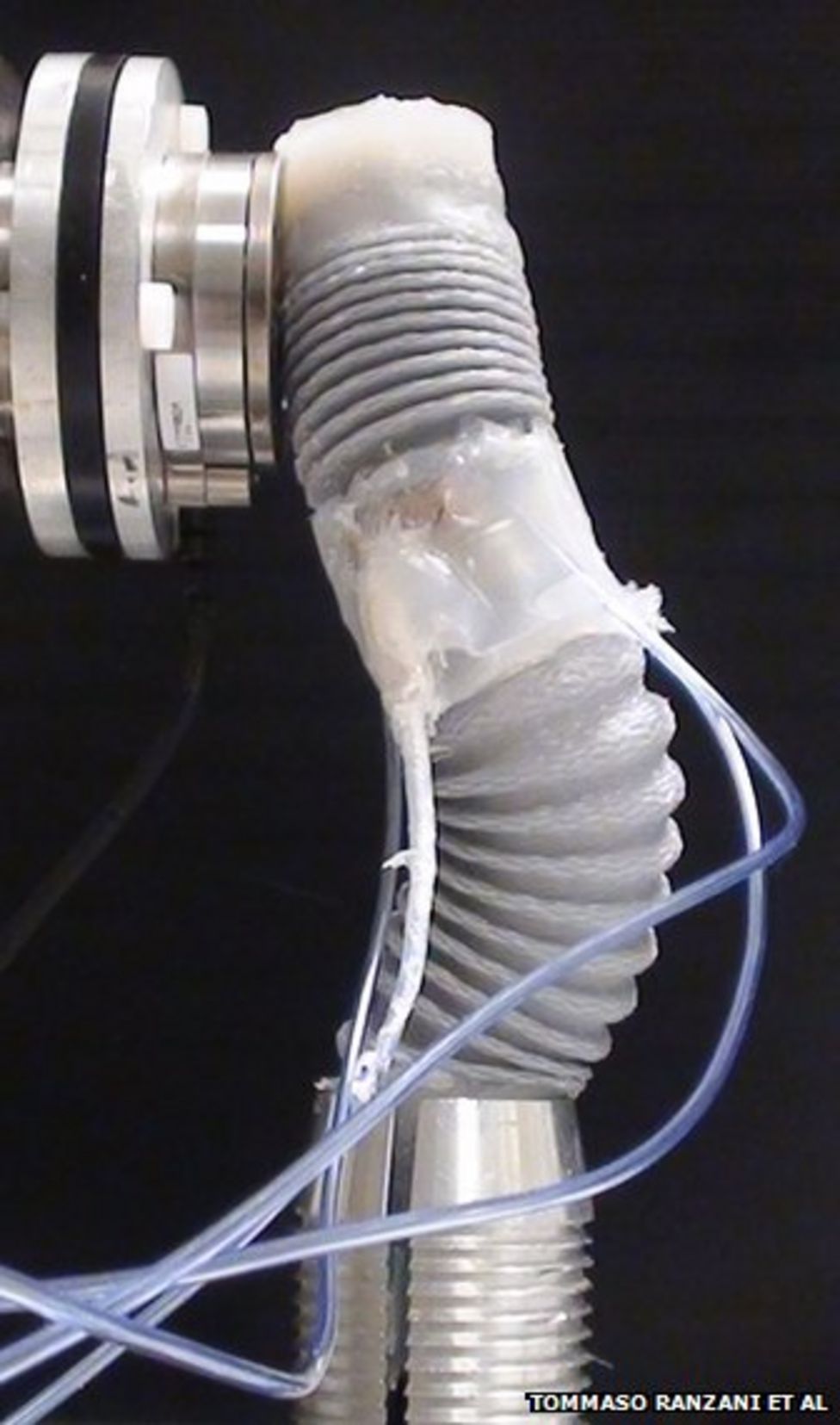 Robotic tentacle targets keyhole surgery - BBC News