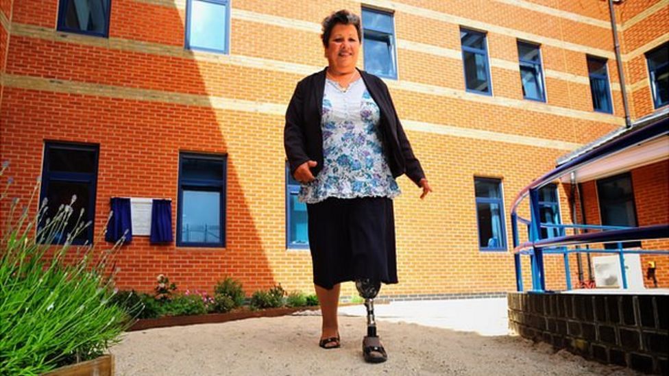 How do amputees learn to walk again? - BBC News