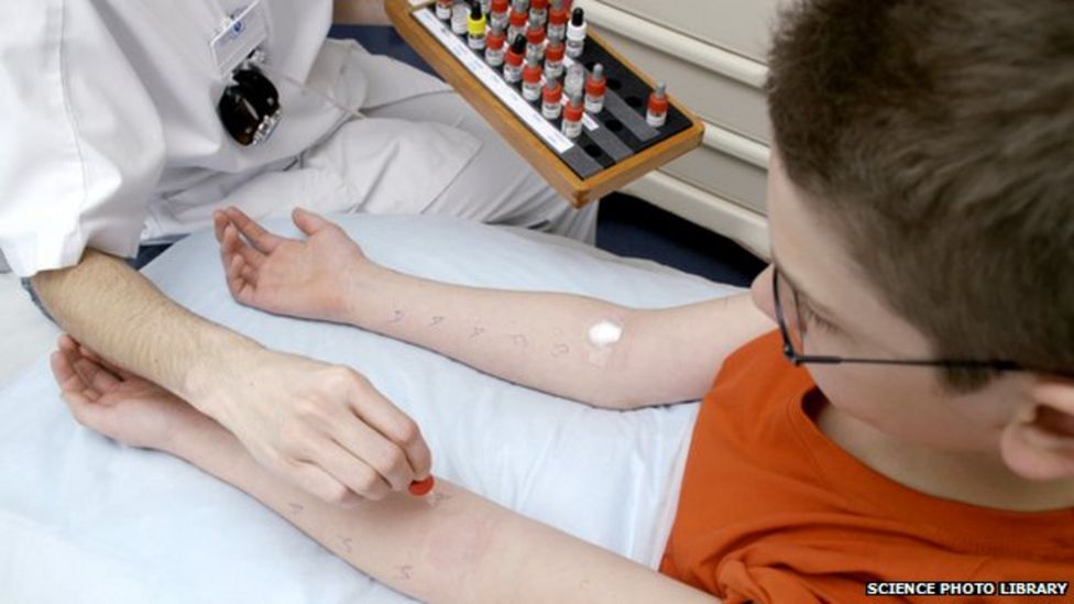Warning over 'dodgy' allergy tests - BBC News