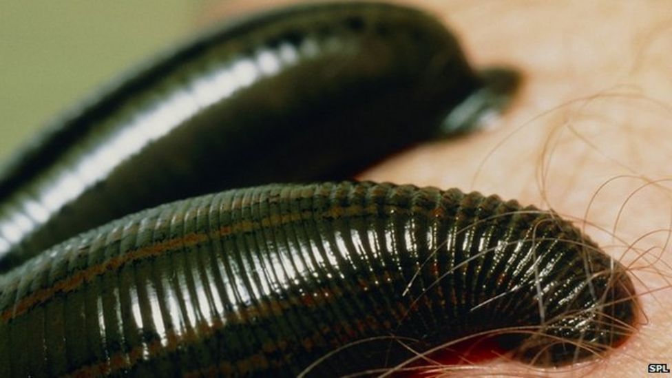 Medicinal leech farming making a comeback in Wales - BBC News