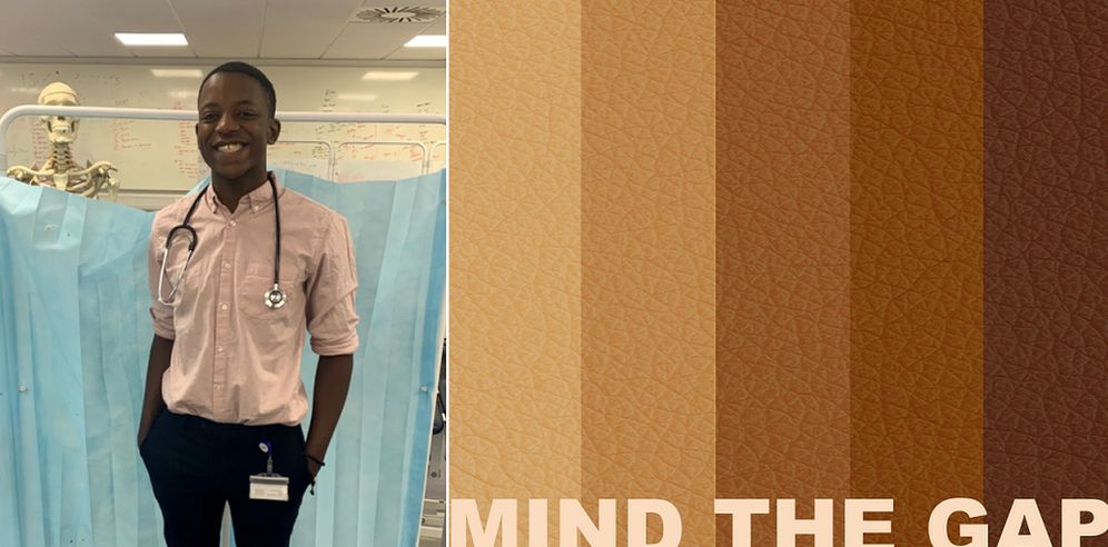 NHS project tackles diversity of skin tones in medical photos - BBC ...