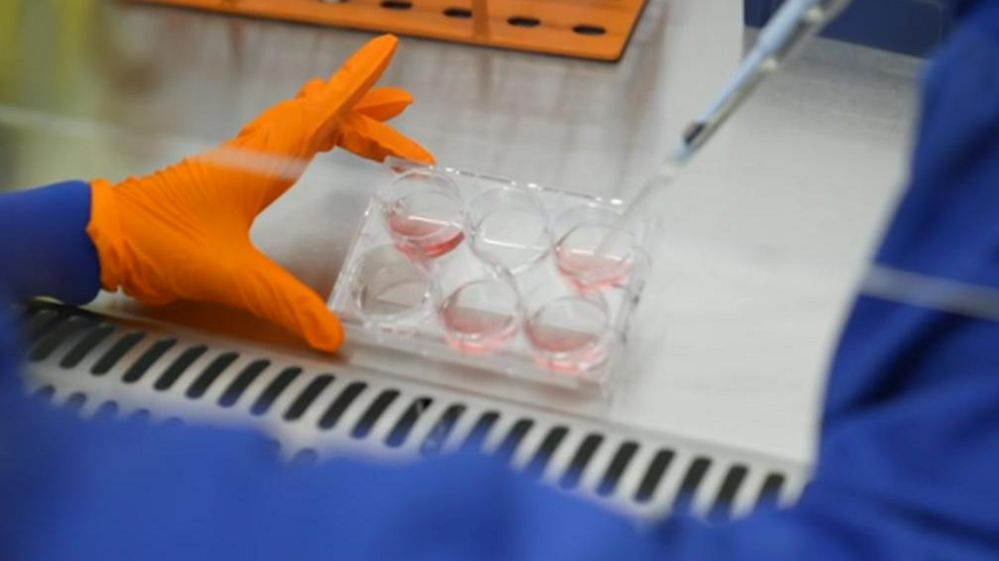 Lab-grown blood gives hope says sickle cell sufferer - BBC News