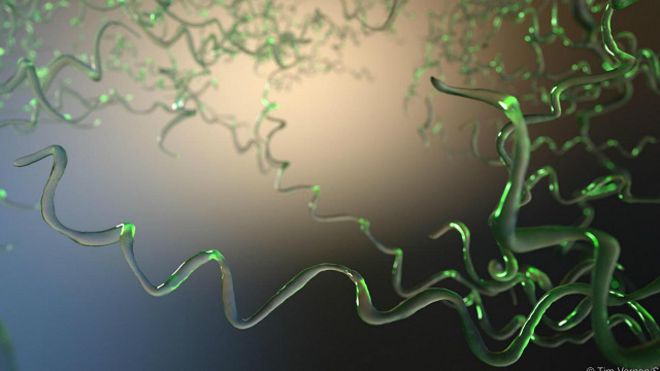 Kaswende na Kisonono vyaenea kwa kasi Uingereza - Madibadc