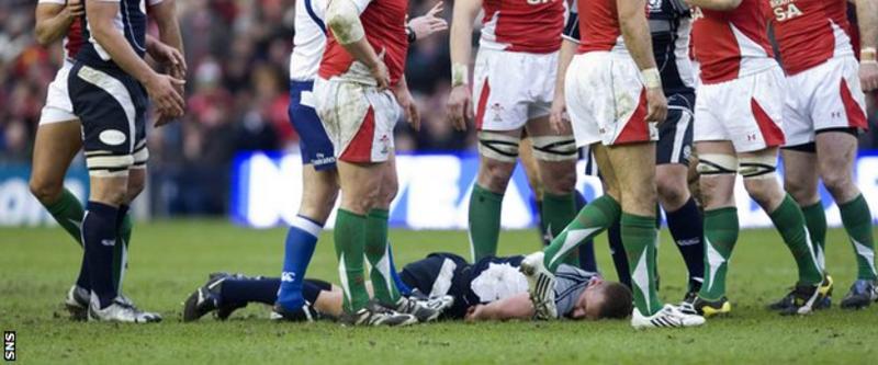 Concussion in rugby: Brain expert calls for limit to contact training ...