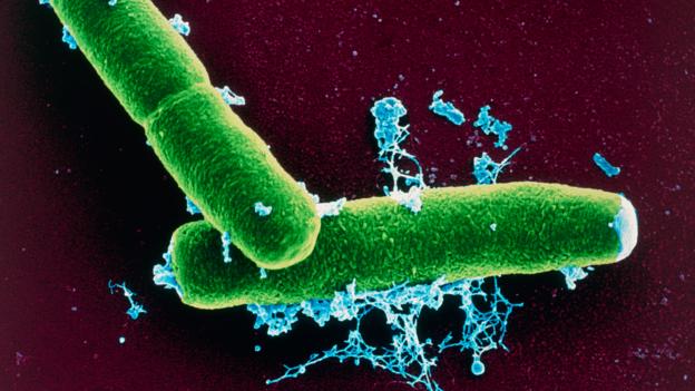 BBC - Earth - Our ancestors may have spread anthrax all around the world